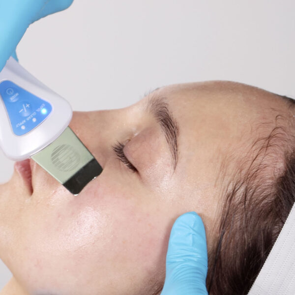 bt-micro fusion PRO ultrazvučna špatula | Mikro.hr